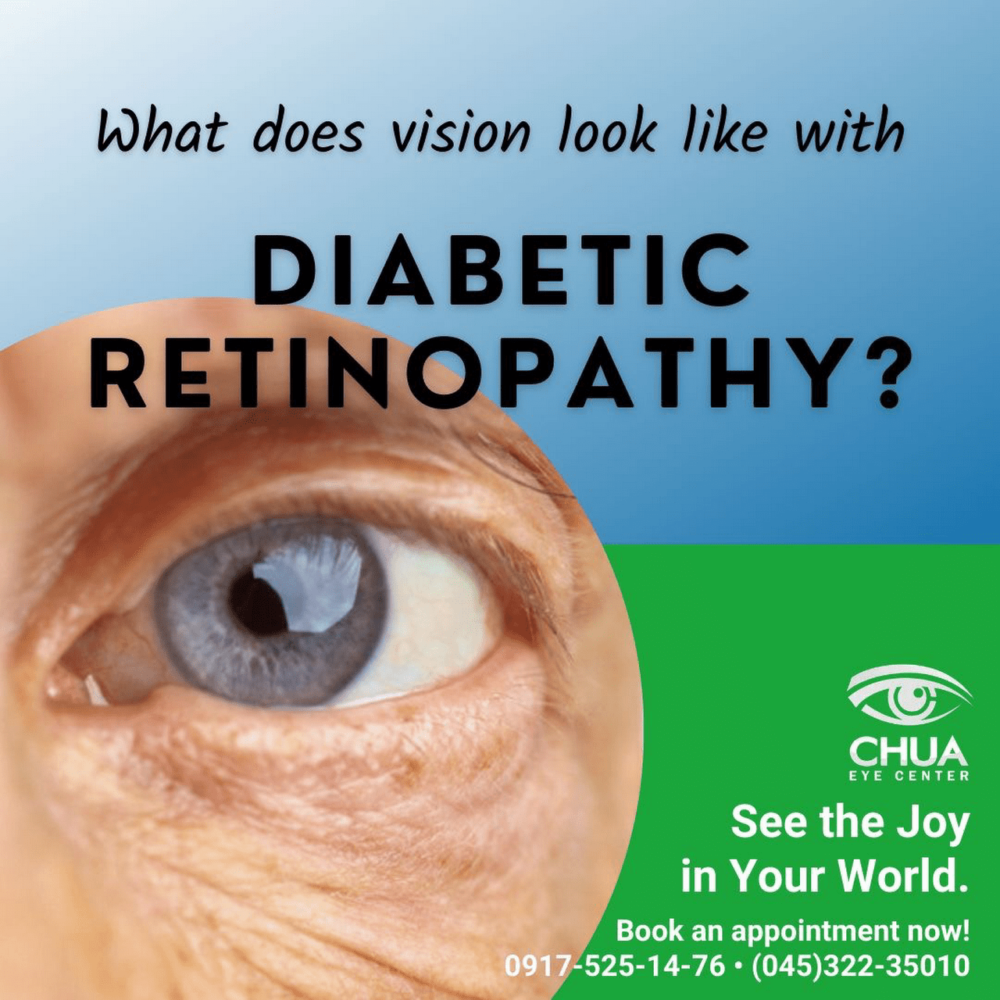 Chua Eye Care Center, Pampanga